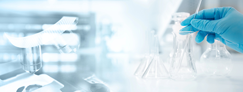 CleanControlling: Importance and Limitations of the TOC analysis ...